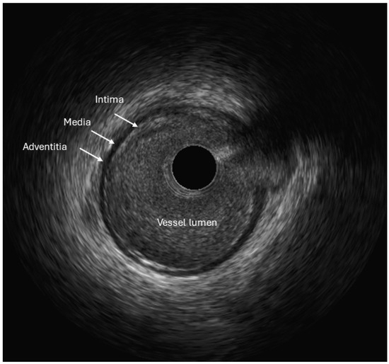 Innovations in Intracoronary Imaging: Present Clinical Practices and ...