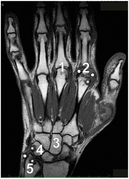 Magnetic Resonance Imaging (MRI)-Based Semi-Quantitative Methods for ...