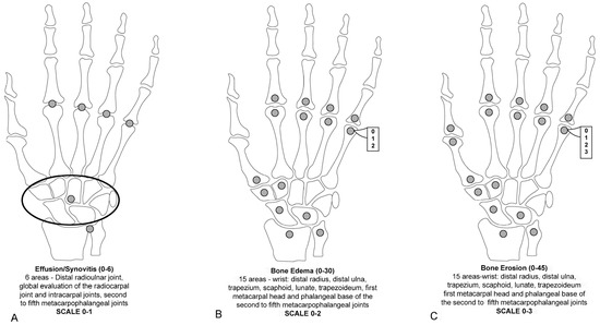 Magnetic Resonance Imaging (MRI)-Based Semi-Quantitative Methods for ...