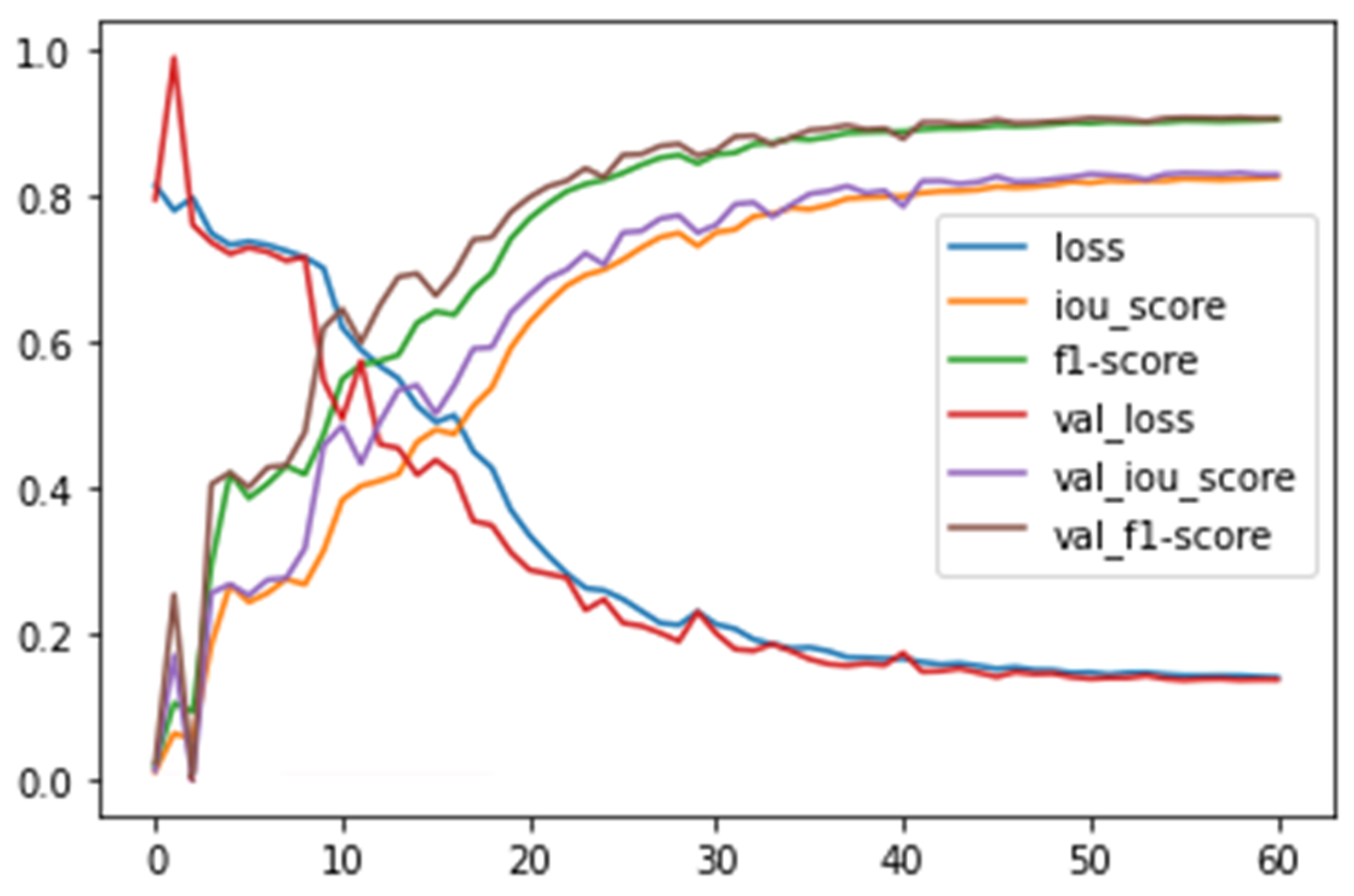 Deep Learning in Cardiothoracic Ratio Calculation and Cardiomegaly Detection