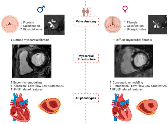 Jcm Free Full Text Sex Differences In Aortic Stenosis From The