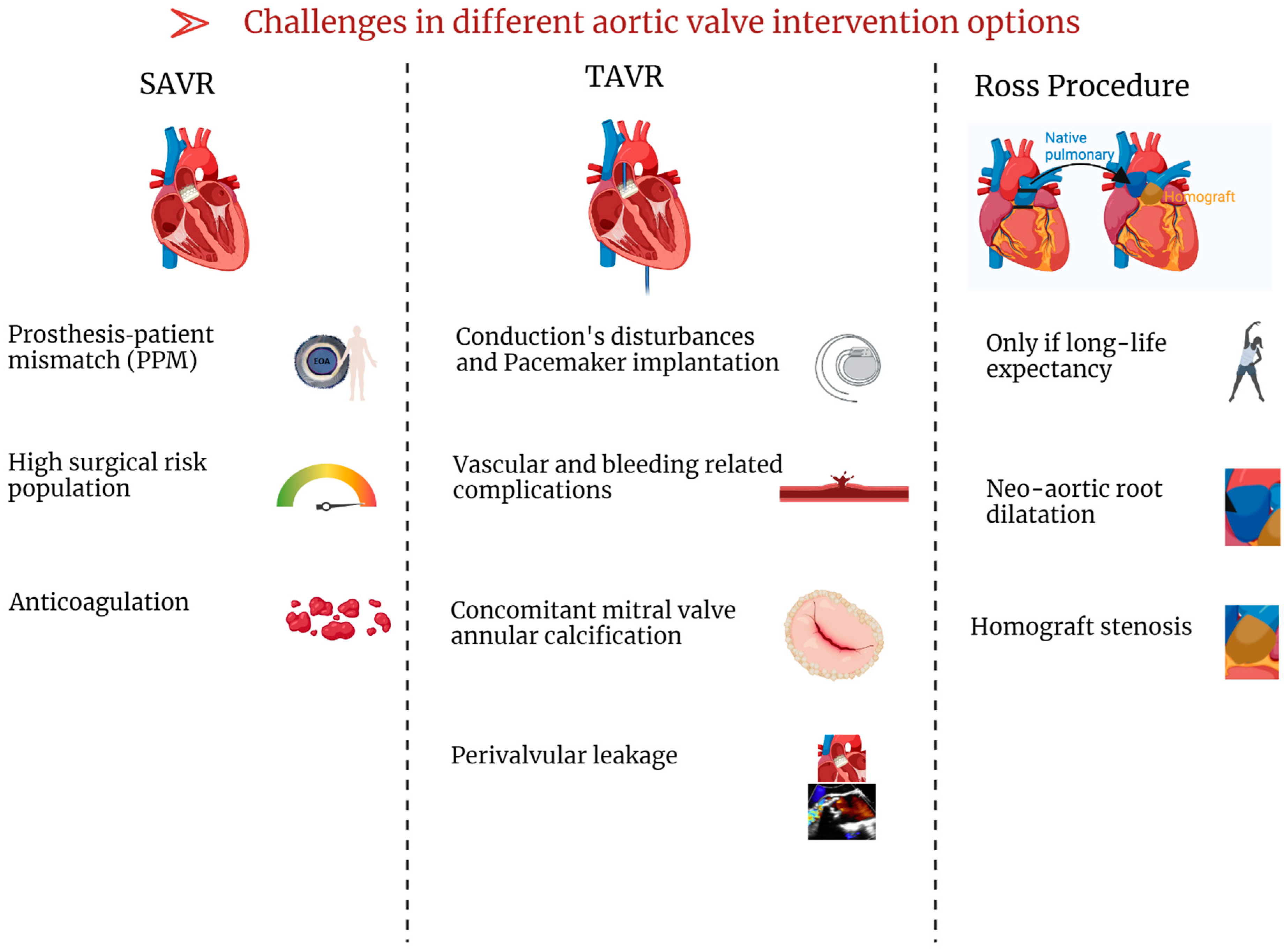 Jcm Free Full Text Sex Differences In Aortic Stenosis From The