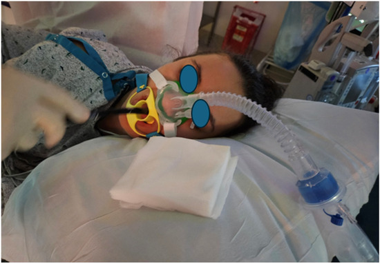 Setting Up an Ambulatory GI Endoscopy Suite in the USA—Anesthesia and ...