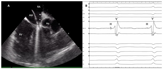 JCM | Free Full-Text | Comparison of Conventionally Performed and ...