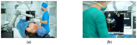 Non-Invasive Ultrasound Therapy for Severe Aortic Stenosis: Early ...