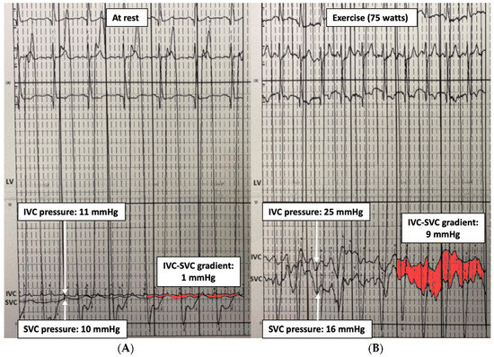 JCM | Free Full-Text | Advances in Diagnostic and Interventional ...