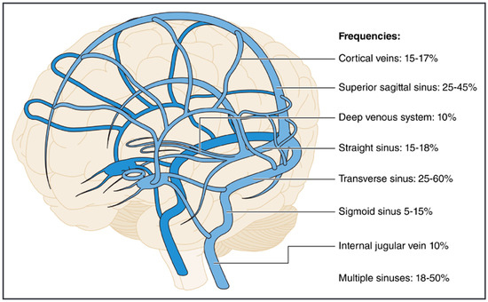 Cerebral Vein Thrombosis and Direct Oral Anticoagulants: A Review