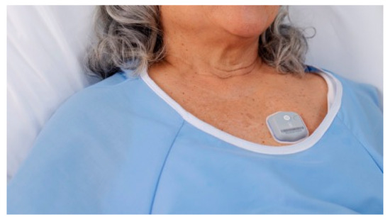 A Retrospective Observational Study of Continuous Wireless Vital Sign ...
