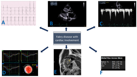 Contemporary Multimodality Imaging for Diagnosis and Management of ...