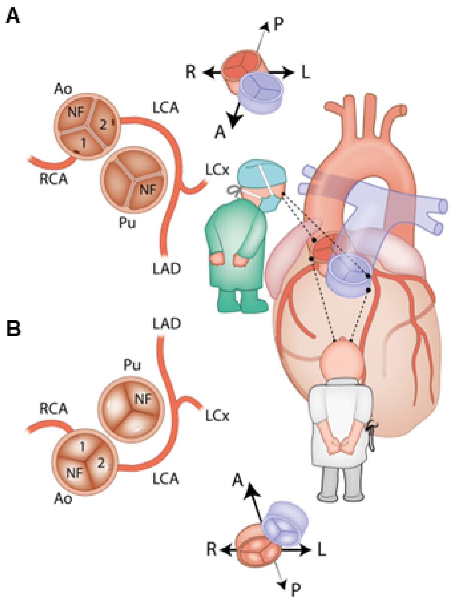JCM | Free Full-Text | Pathogenesis and Surgical Treatment of Dextro ...
