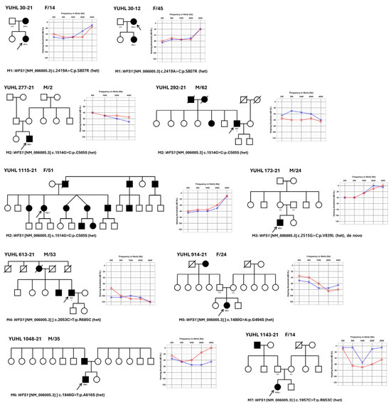 JCM | Free Full-Text | Clinical Characteristics and Audiological ...