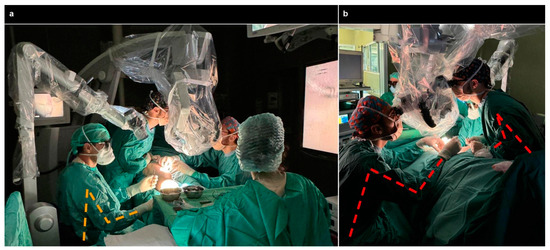 Exoscope and Supermicrosurgery: Pros and Cons of 3D Innovation in ...