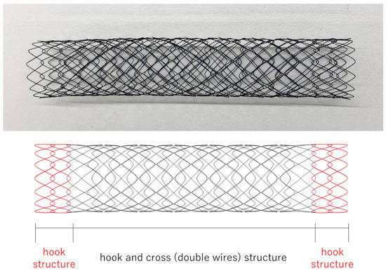 A New Self-Expandable Metallic Stent with Low Axial Force and a High ...