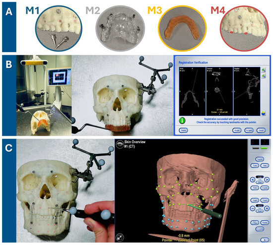 Intraoral Scanning Enables Virtual-Splint-Based Non-Invasive ...