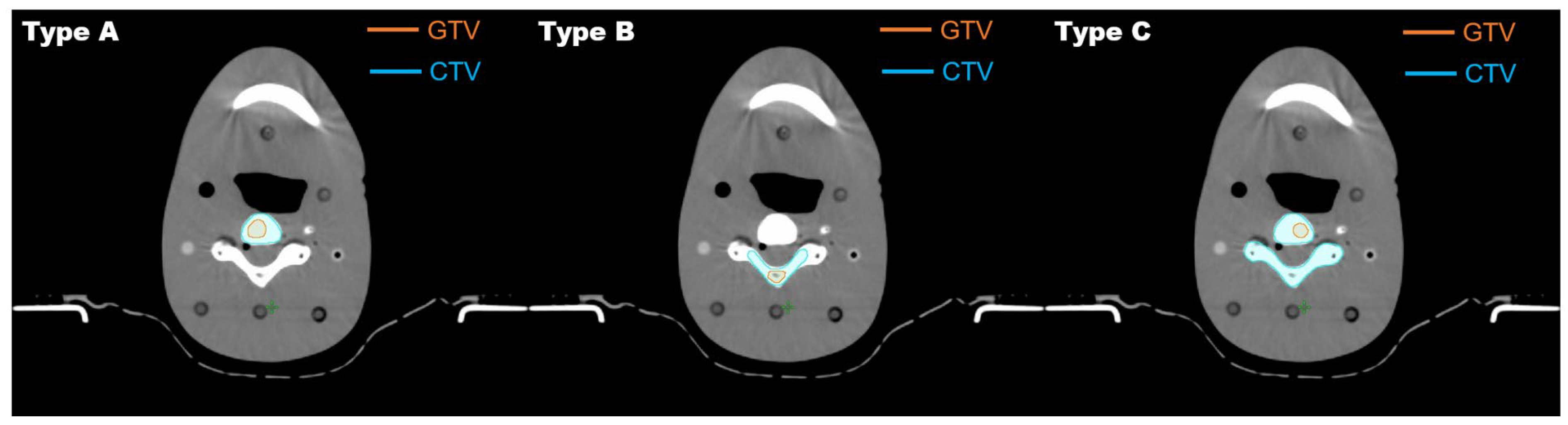 Dosimetric Comparison between the HyperArc and Conventional VMAT in ...
