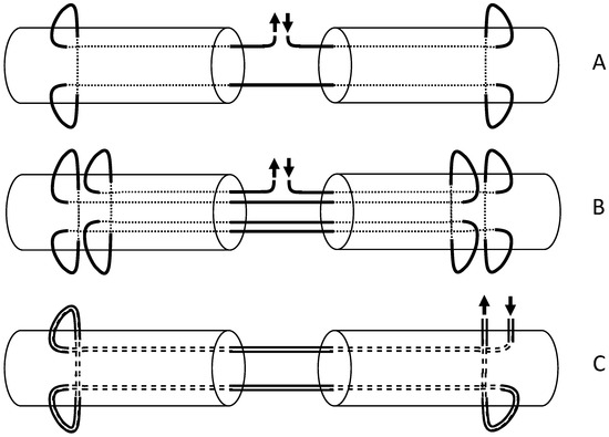 Biomechanical Comparison of Three Modified Kessler Techniques for ...