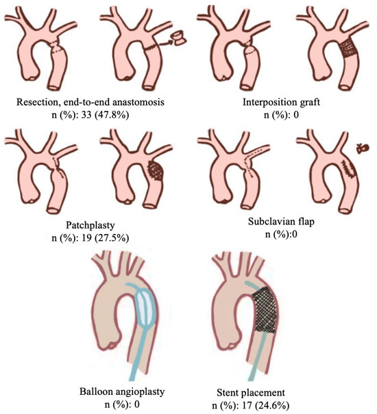 Comparative Analysis of Surgical and Endovascular Approaches for ...