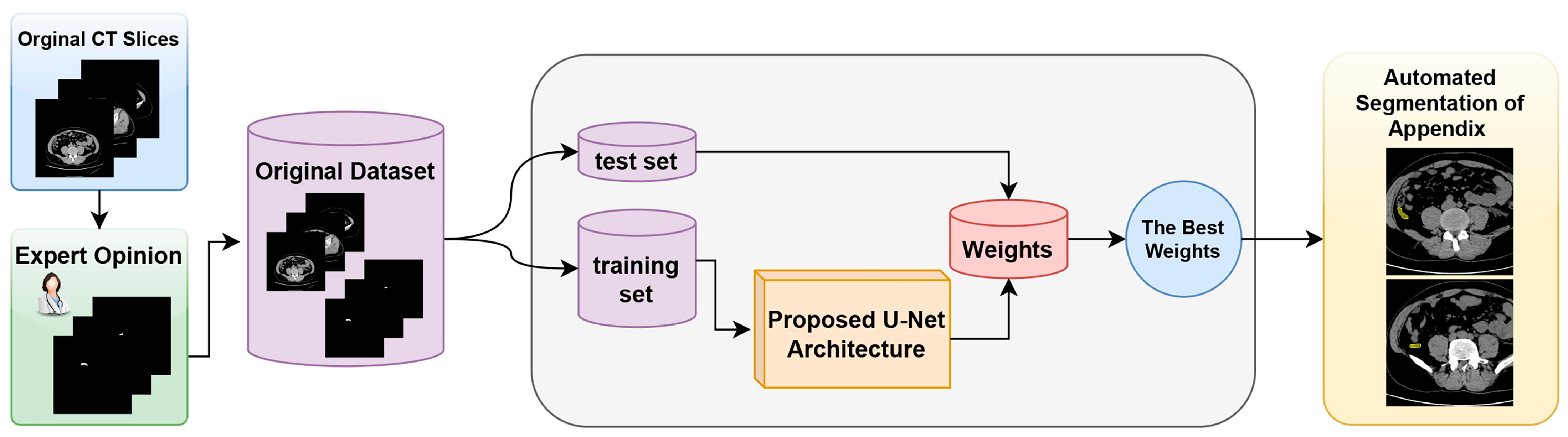 Fully Automated Detection of the Appendix Using U-Net Deep Learning Architecture in CT Scans