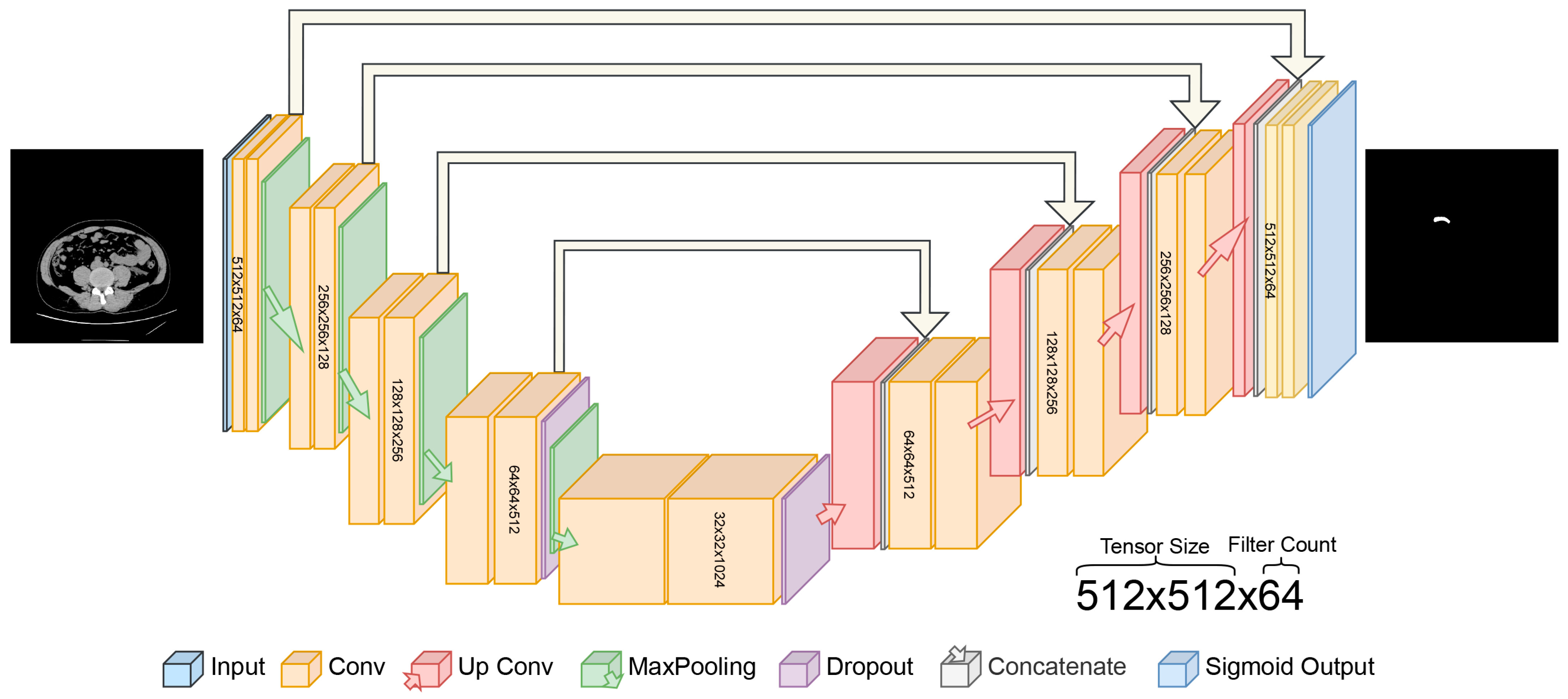Fully Automated Detection of the Appendix Using U-Net Deep Learning Architecture in CT Scans