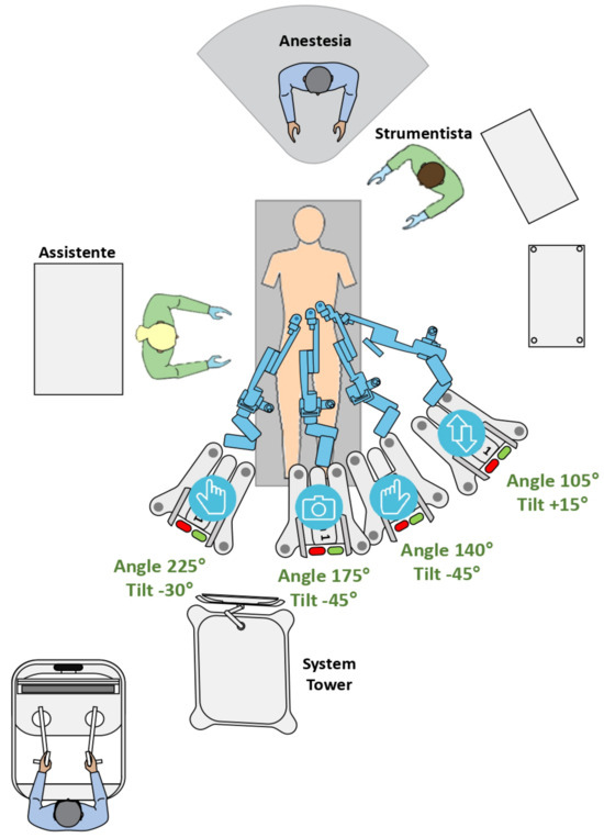 Extraperitoneal Robot-Assisted Radical Prostatectomy with the Hugo™ RAS ...