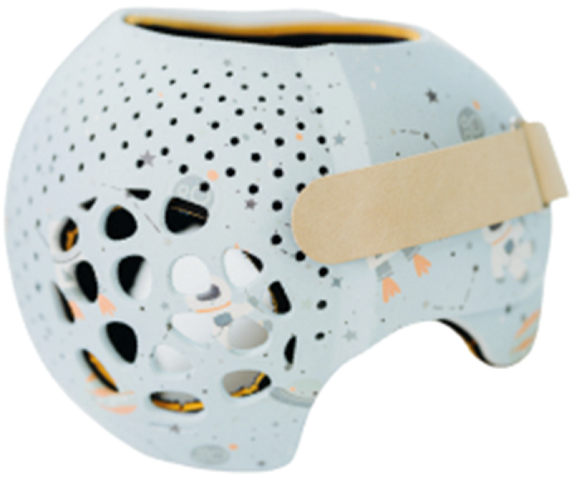 Therapeutic Effectiveness of a Novel Cranial Remolding Helmet (baby band2) for Positional ...