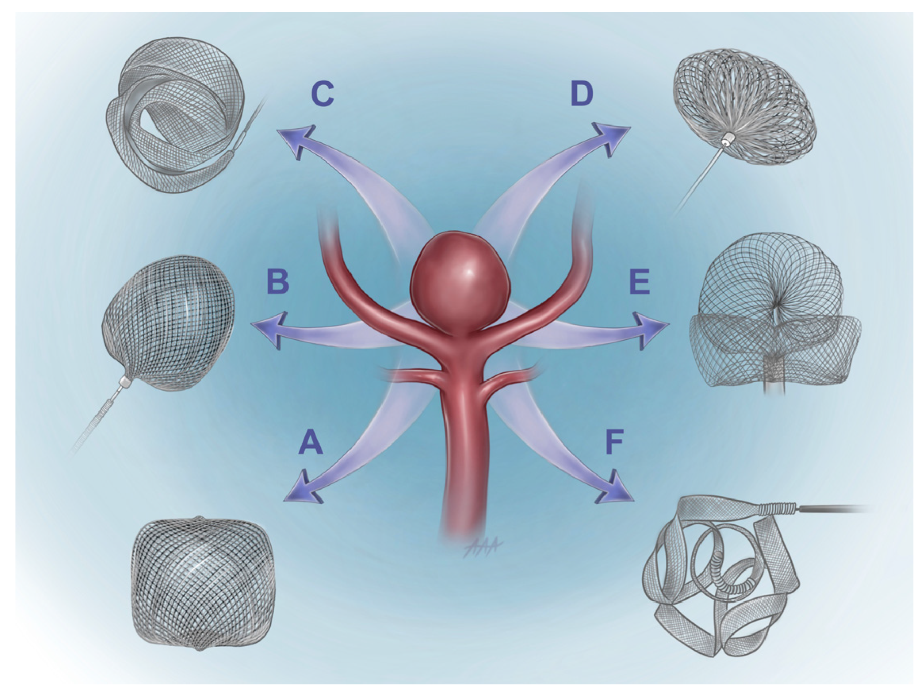 Intrasaccular Treatment of Intracranial Aneurysms: A Comprehensive Review