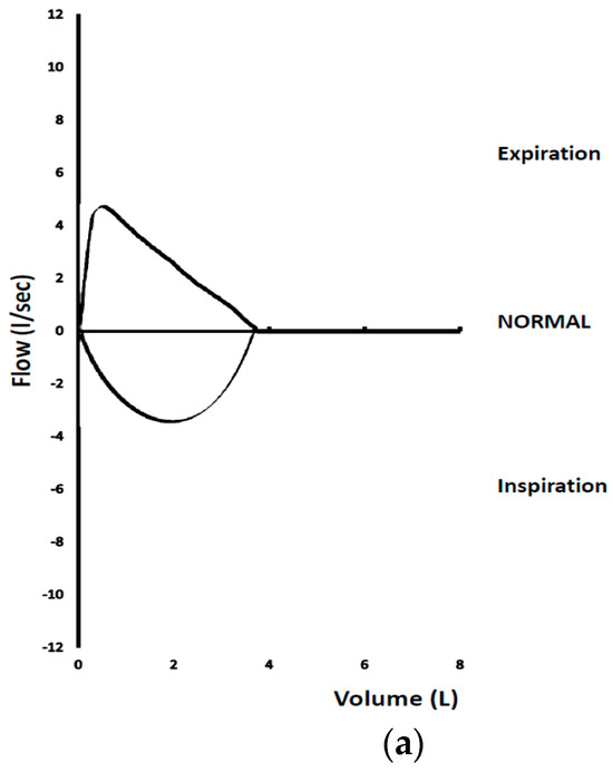 The Clinical Utility of Pulmonary Function Tests in the Diagnosis and ...