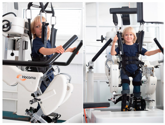 Assessing the Efficacy of Lokomat Training in Pediatric Physiotherapy for Cerebral Palsy: A ...