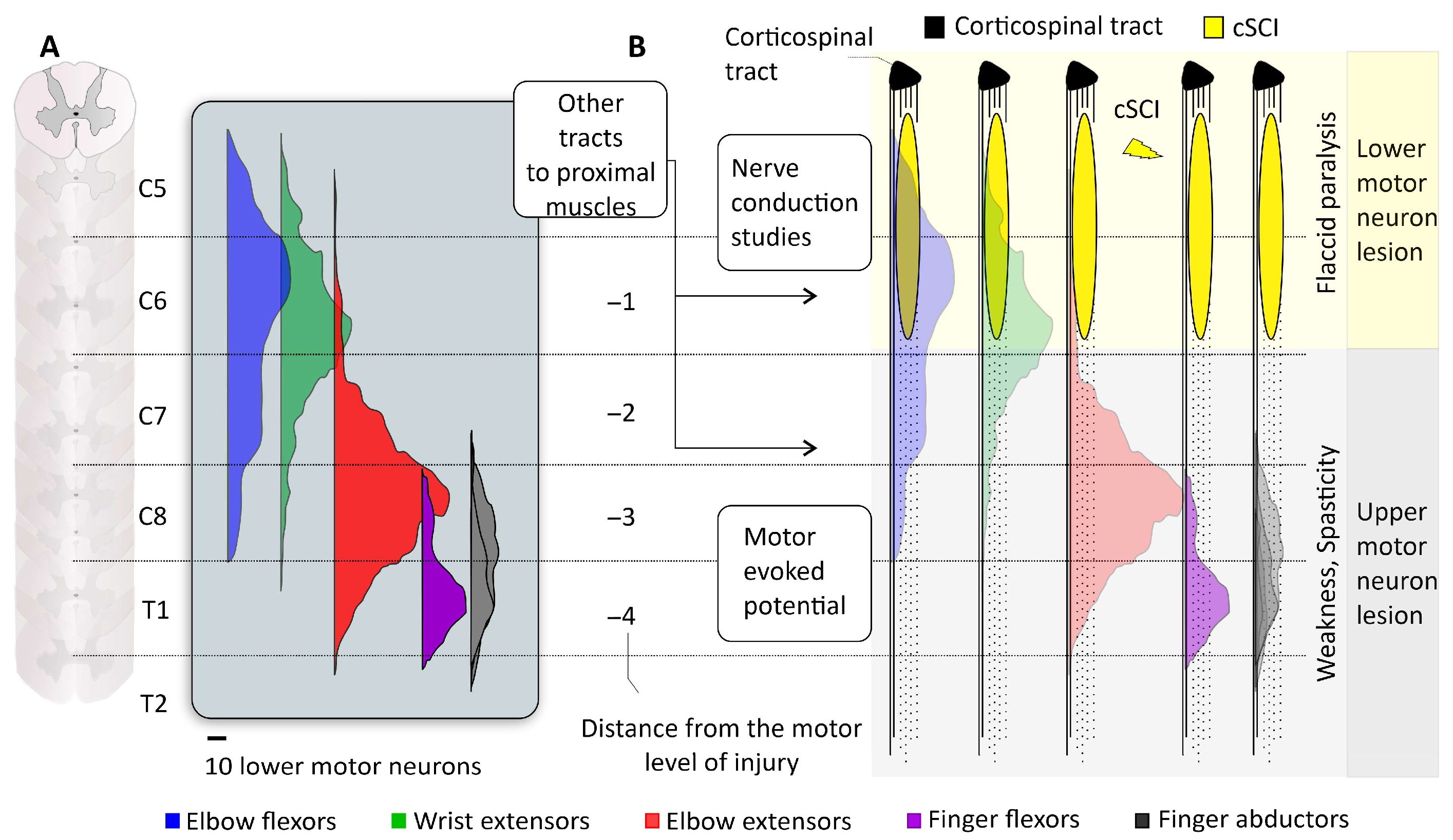 Corticospinal Tract Sparing in Cervical Spinal Cord Injury