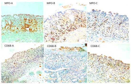 The Combined Administration of Eicosapentaenoic Acid (EPA) and Gamma ...