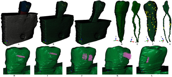 Ischemic Risks Induced by Larger Orthodontic Forces on Dental Pulp and ...