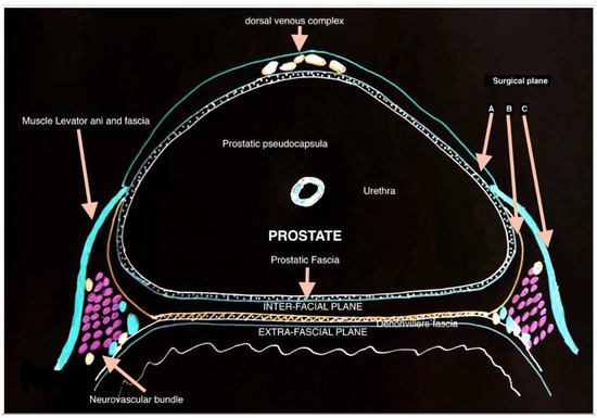 Factors Contributing to Early Recovery of Urinary Continence Following ...