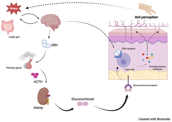 A Narrative Review on Stress and Itch: What We Know and What We Would ...