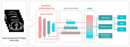 Detection of Aortic Dissection and Intramural Hematoma in Non-Contrast Chest Computed Tomography ...