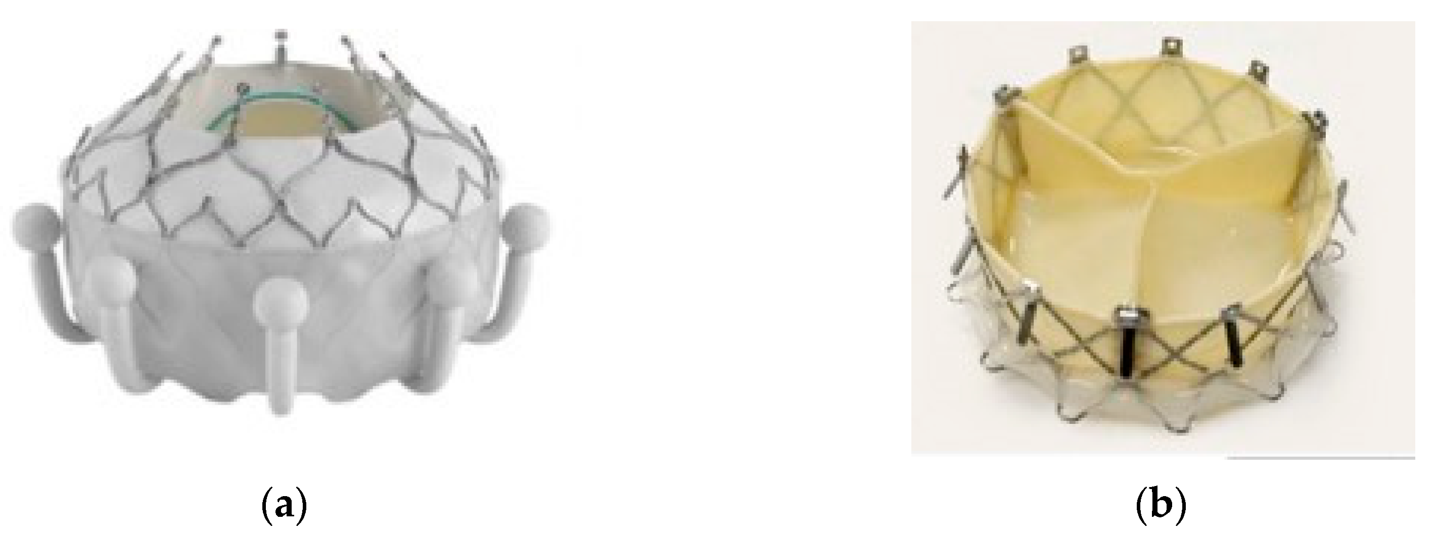 Transcatheter Tricuspid Regurgitation Repair—An Overview of Techniques ...