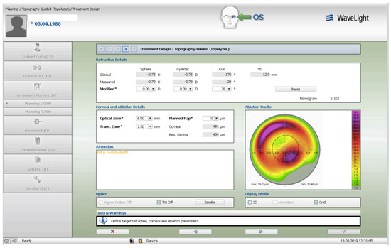 Progressive Keratoconus Treatment with Transepithelial Two-Step ...