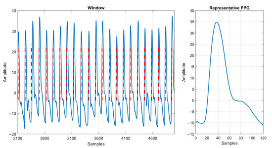Machine Learning-Based Cardiac Output Estimation Using ...