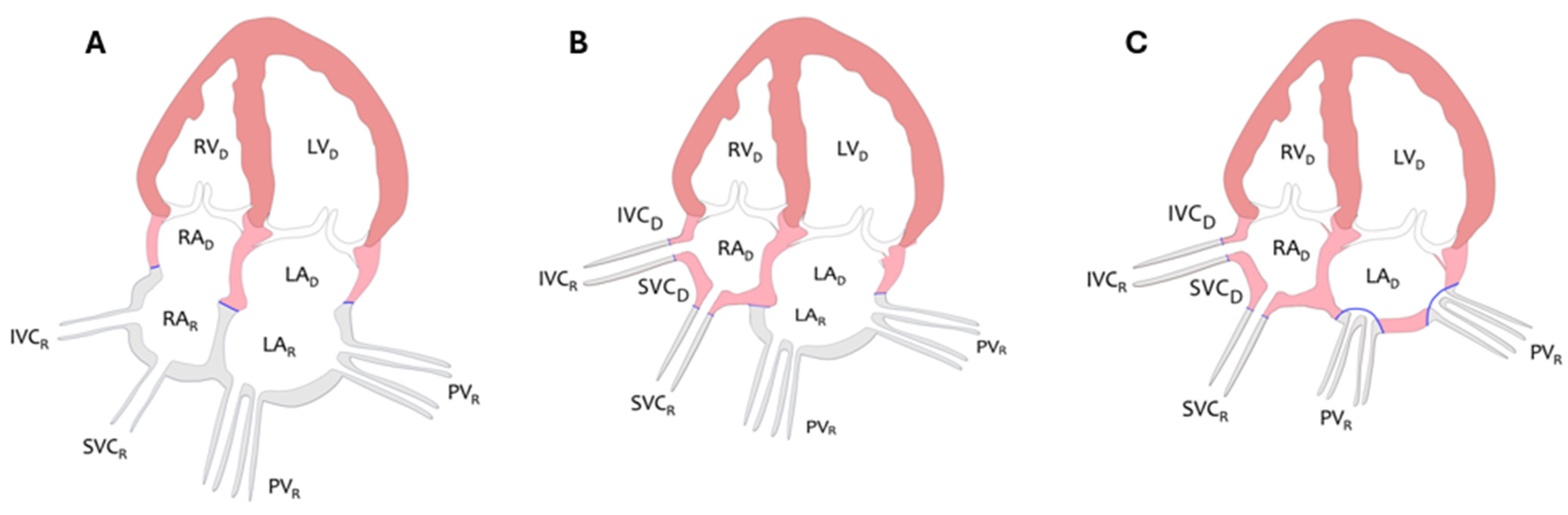 Left Atrial Functional and Structural Characteristics in Patients After ...