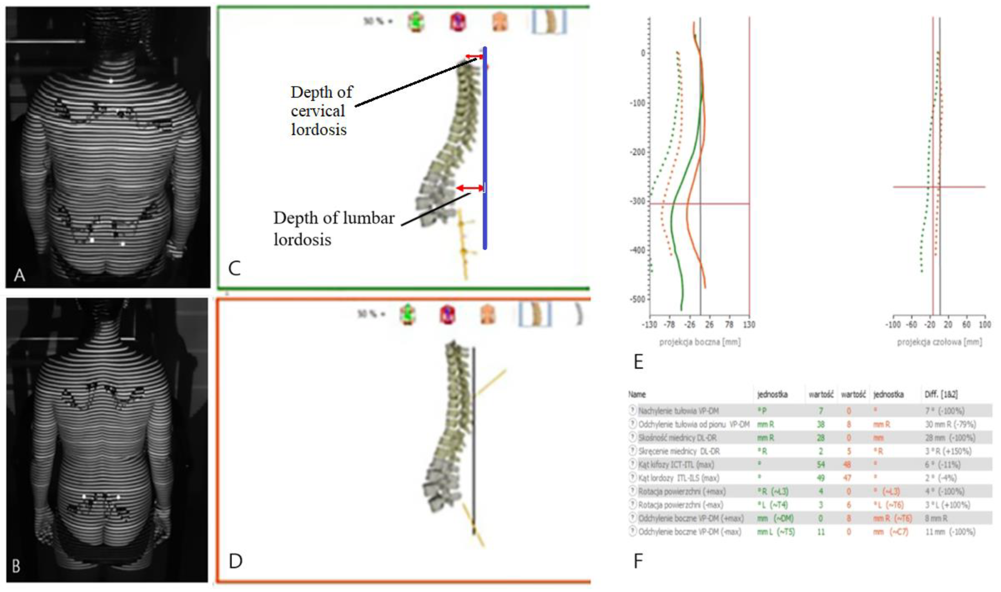 Targeted Motor Control Considering Sternal Position Improves Spinal ...