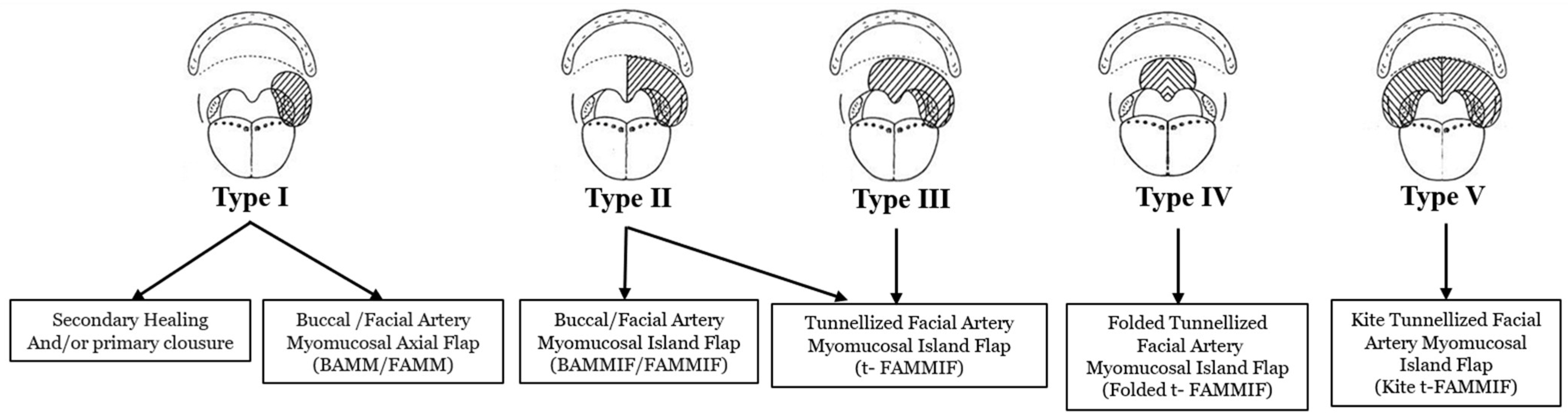 New Classification System and Defect-Oriented Algorithm for Functional Soft-Palate ...