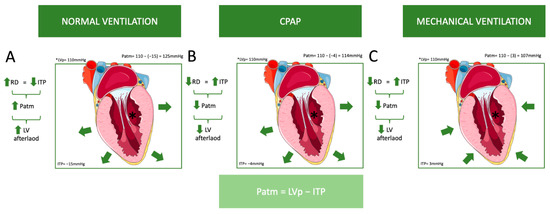 Navigating Heart–Lung Interactions in Mechanical Ventilation ...