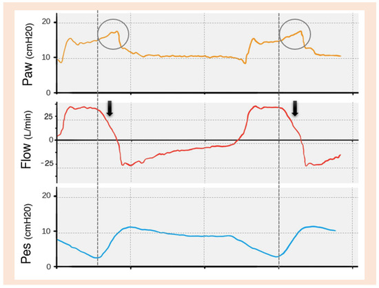 Optimizing Mechanical Ventilation: A Clinical and Practical Bedside ...