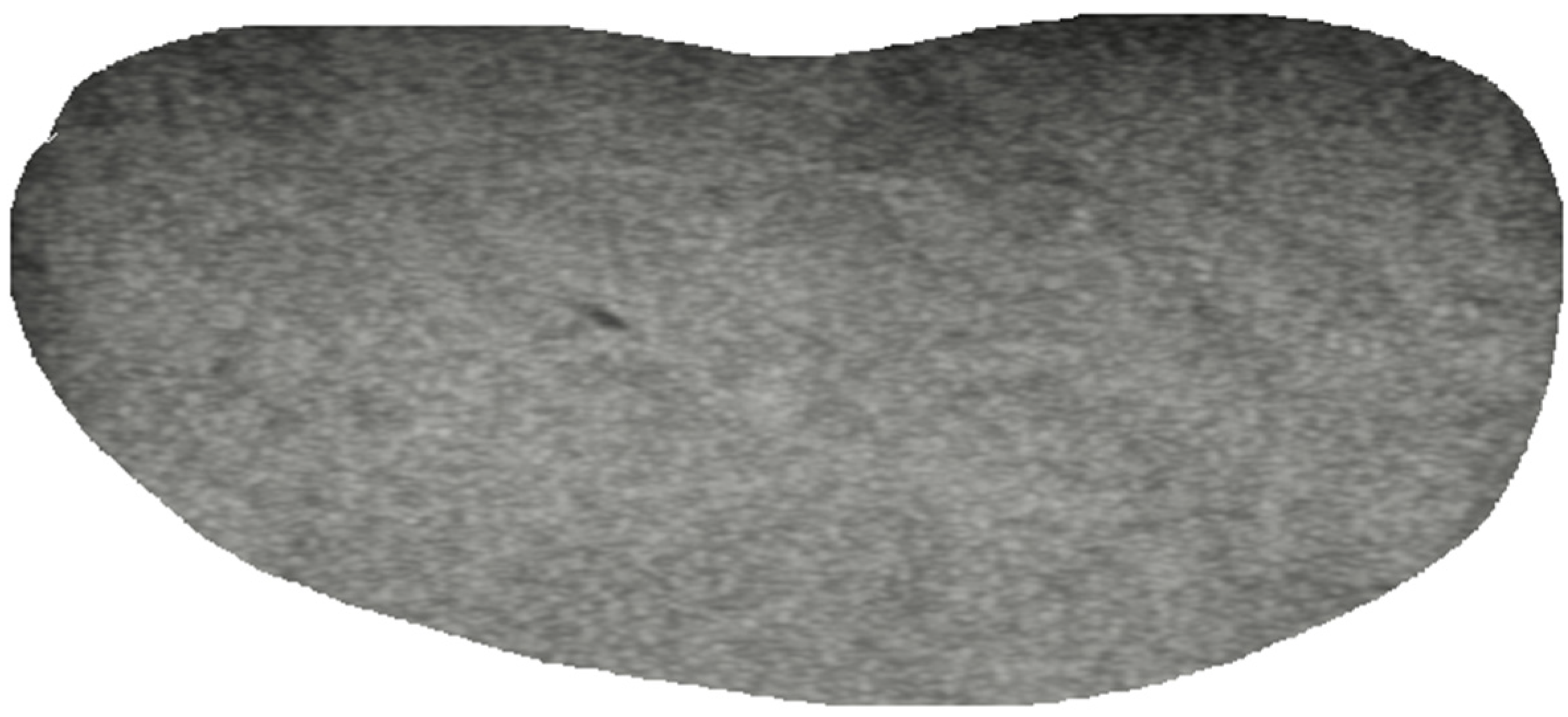 Predicting Semen Analysis Parameters from Testicular Ultrasonography ...