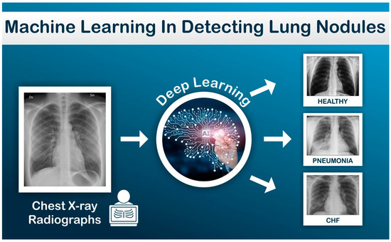 Revolutionizing Cardiology: The Role of Artificial Intelligence in ...