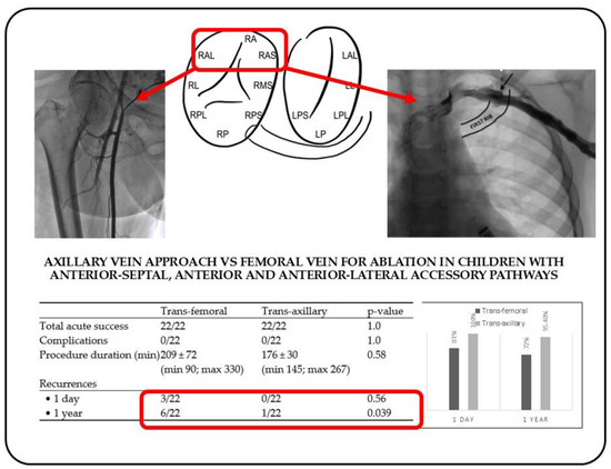 The Trans-Axillary Vein Approach for the Ablation of Anterior–Septal ...