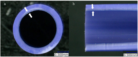 Efficacy of a Novel Dual-Layer Plastic Stents for Malignant Biliary ...