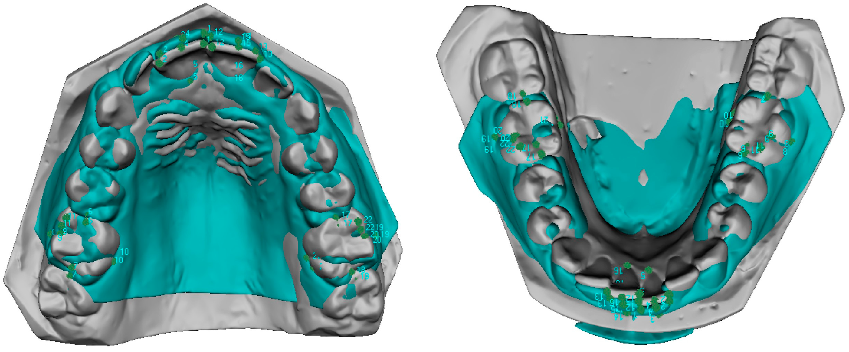 Analysis of Natural Clinical Crown Height Changes in Central Incisors ...