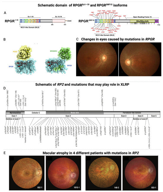 Pre-Clinical and Clinical Advances in Gene Therapy of X-Linked ...
