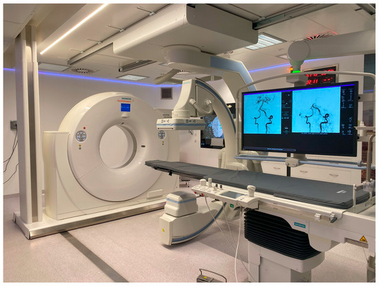 Hybrid CT Angio Suite for Acute Ischemic Stroke: A New Time-Saving ...