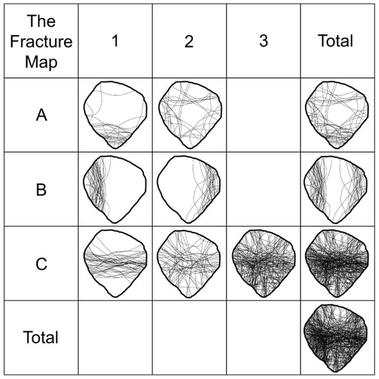 Mapping of Patellar Fracture Patterns: A Multicenter Study of 237 Patients